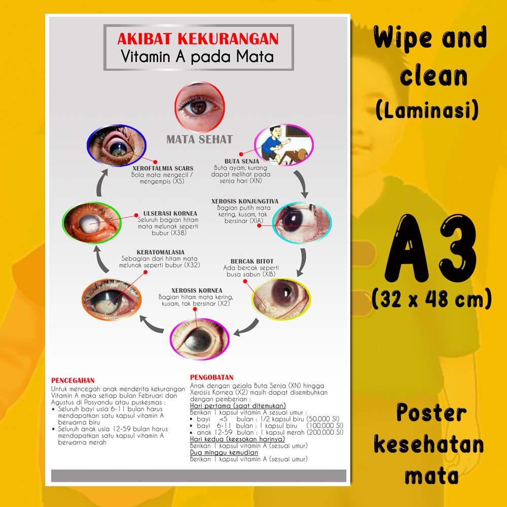 Jual 094 poster kesehatan mata - poster wipe and clean | Shopee Indonesia