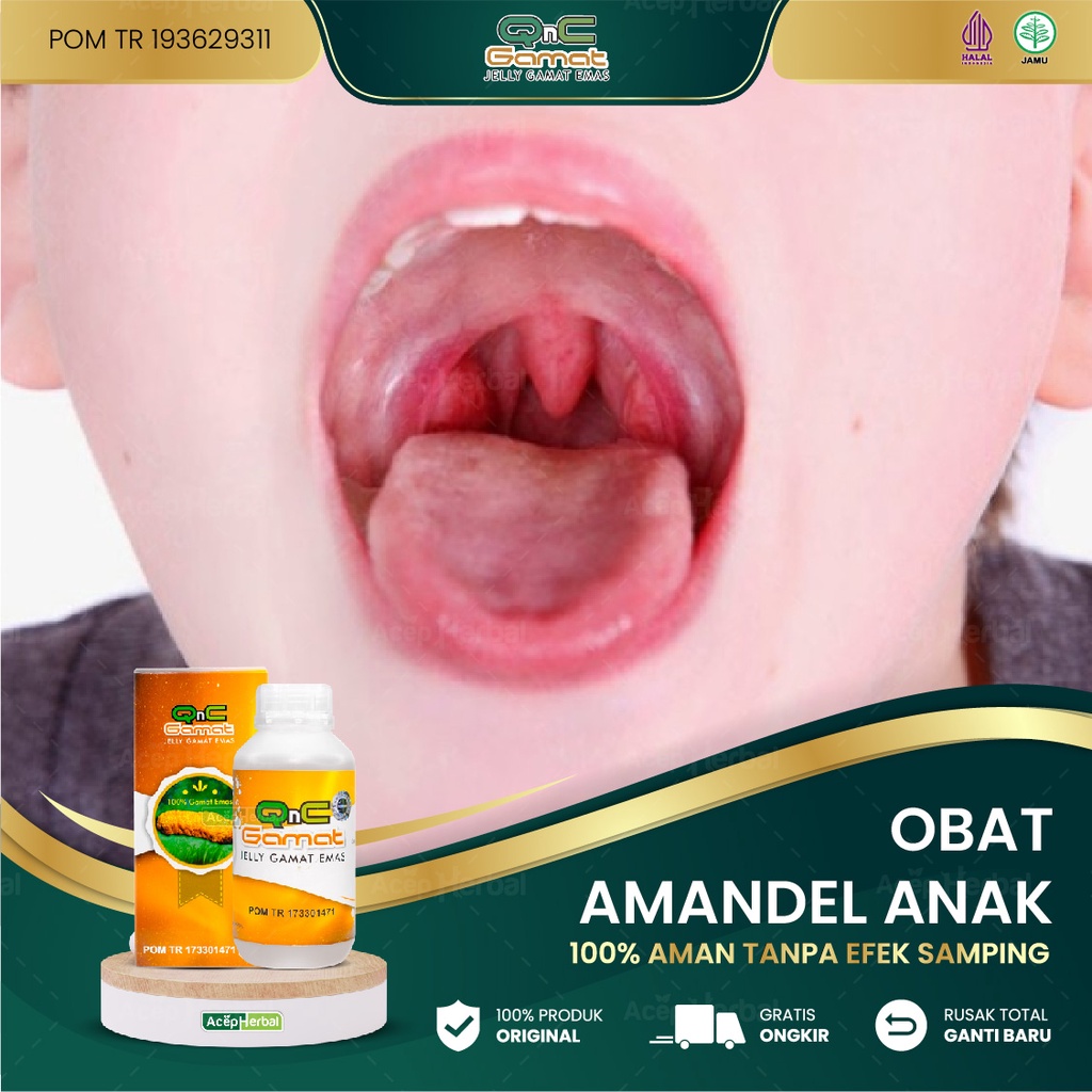 Jual Obat Amandel Untuk Anak Anak2 Radang Tenggorokan Amandel Bernanah Berdarah Basah Berdahak ...