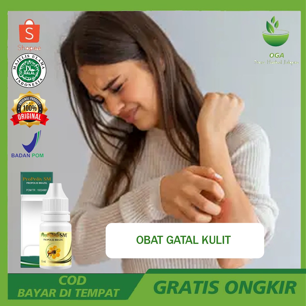 Jual OBAT GATAL SCABIES HERPES DERMATITIS EKSIM ALERGI BIDURAN JAMUR ...