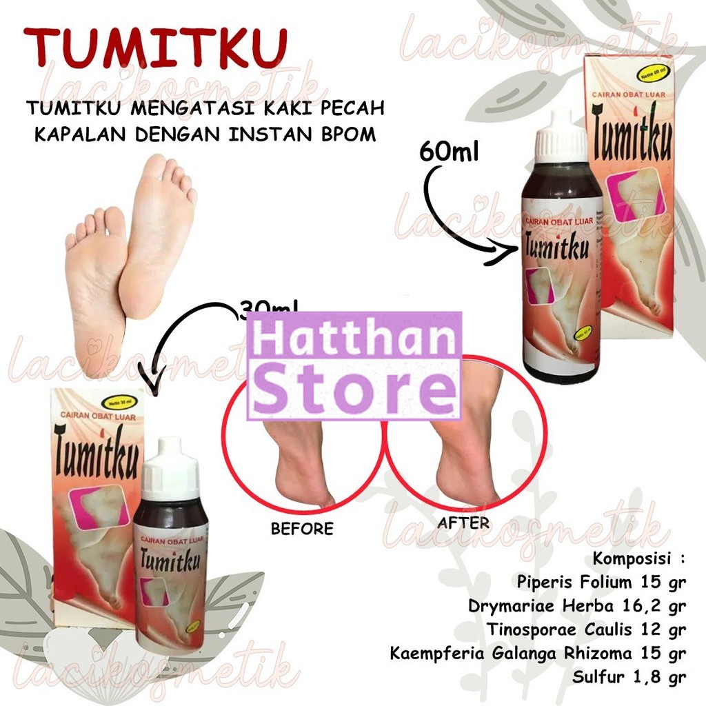 Jual TUMITKU MENGATASI KAKI PECAH - KAPALAN DENGAN INSTAN BPOM | Shopee ...