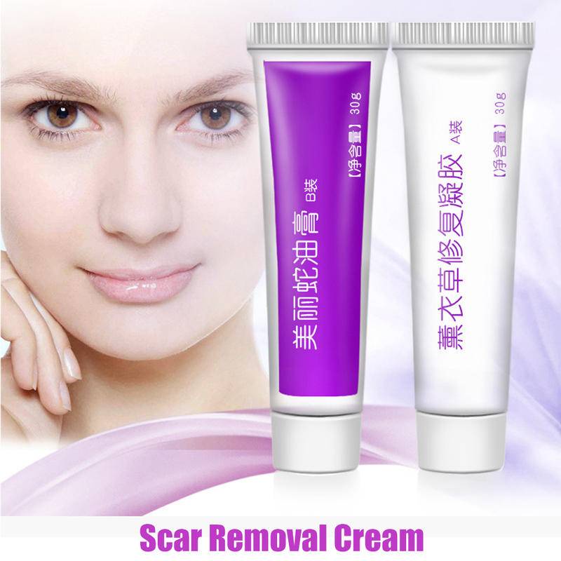 Jual Scar Removal Cream Stretch Mark Repair Cream Epair Burns Remove Acne Marks Old Scars Repair ...
