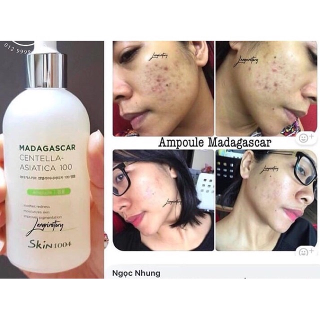 Jual skin1004 skin angel madagascar centella asiatica 100ml (Sudah ...