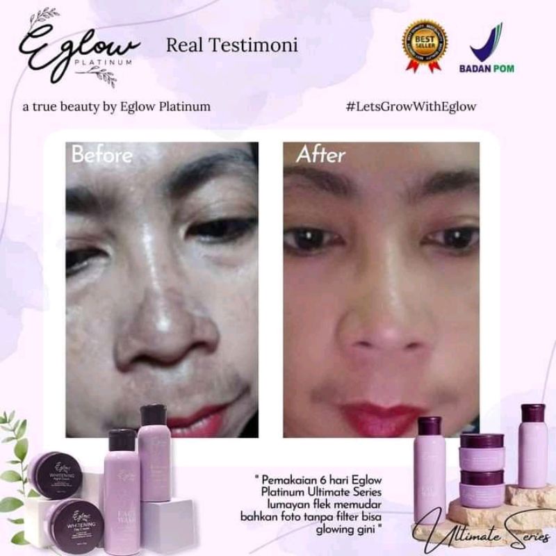 Jual EGLOW PLATINUM KEMASAN NEW paket Whitening100% ORYGINAL | Shopee ...
