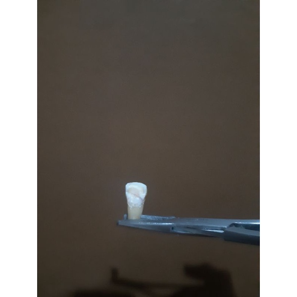 Jual Gigi Insisivus Rahang Atas | Shopee Indonesia