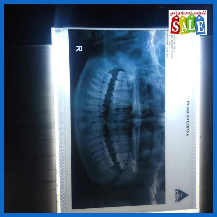 Jual Tulumyairps- Dental Viewer X Ray Led Rontgen Portable A4 Slim ...