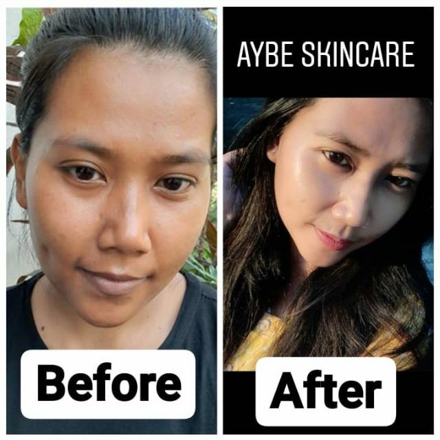 Jual Paket wajah Skincare Aybe Diamond | Shopee Indonesia