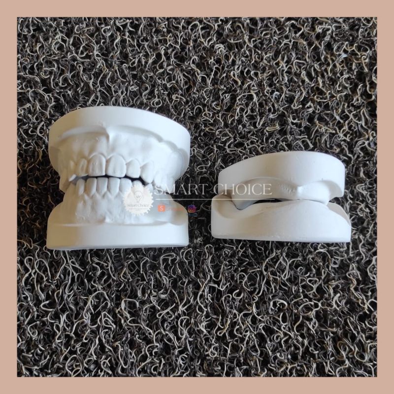 Jual Dental model study gips / model gigi gips / model study gipsum ...