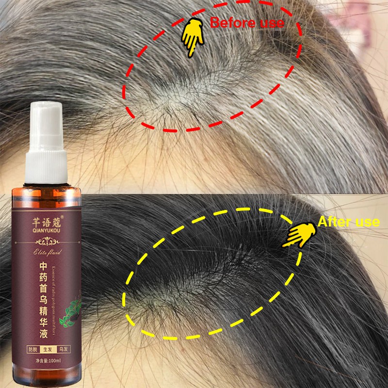 Jual Penumbuh rambut botak Serum penumbuh rambut 100ml Kepala Herbal ...