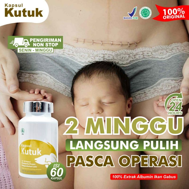 Jual Kapsul kutuk Ekstrak Albumin Ikan Gabus Pasca Operasi Sesar Caesar | Shopee Indonesia