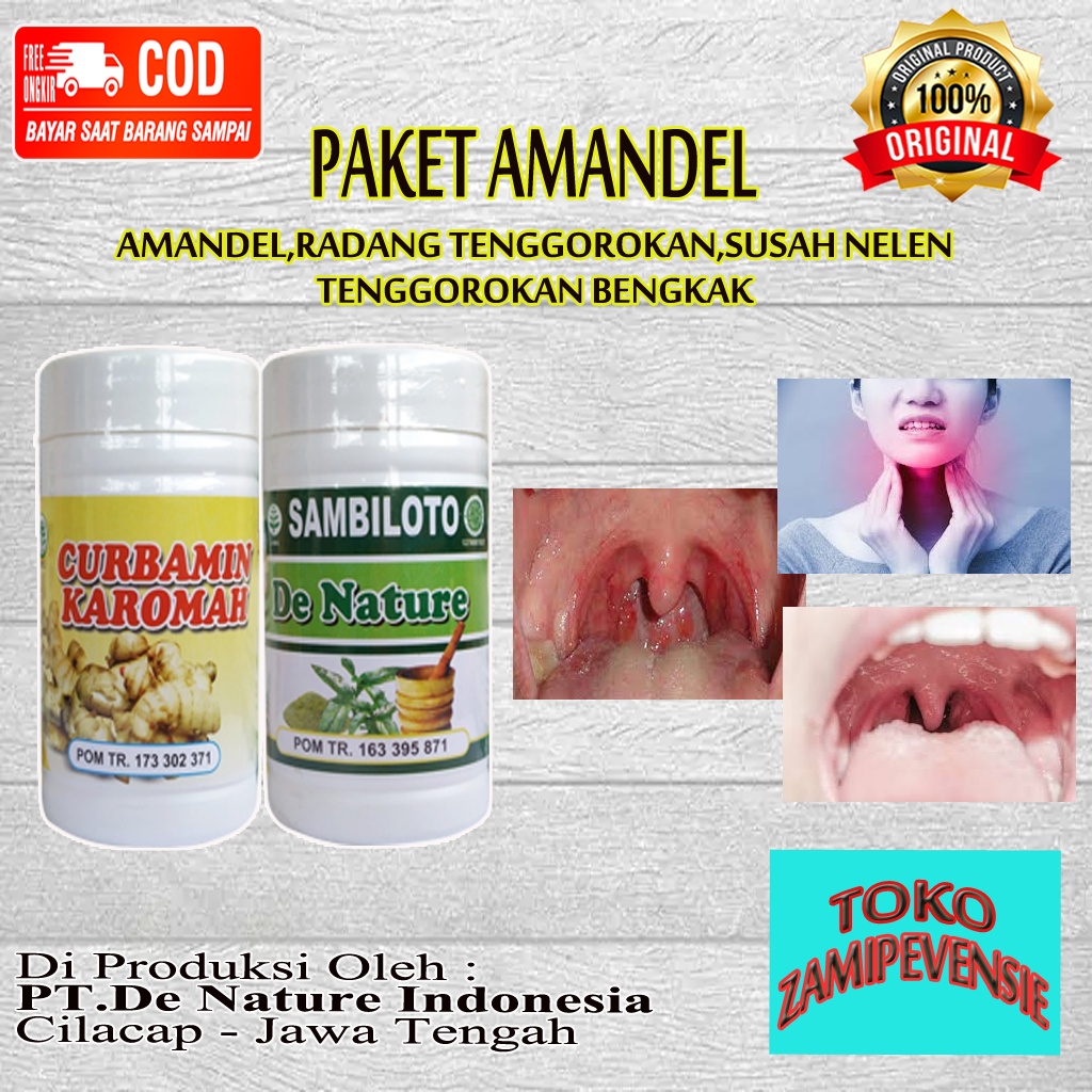 Jual Obat amandel-sakit tenggorokan-radang tenggorokan-susah menelan-amandel batu/besar ...