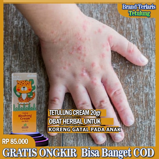 Jual Obat Prurigo, Obat Koreng Gatal, Darah Manis, Bekas Luka Koreng ...