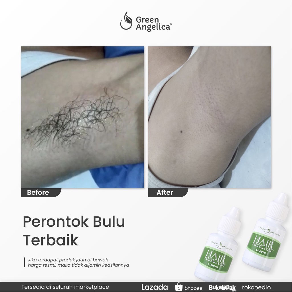 Jual Perontok Bulu Ketiak, Kaki, Tangan Mengatasi Dengan Cepat & Aman ...