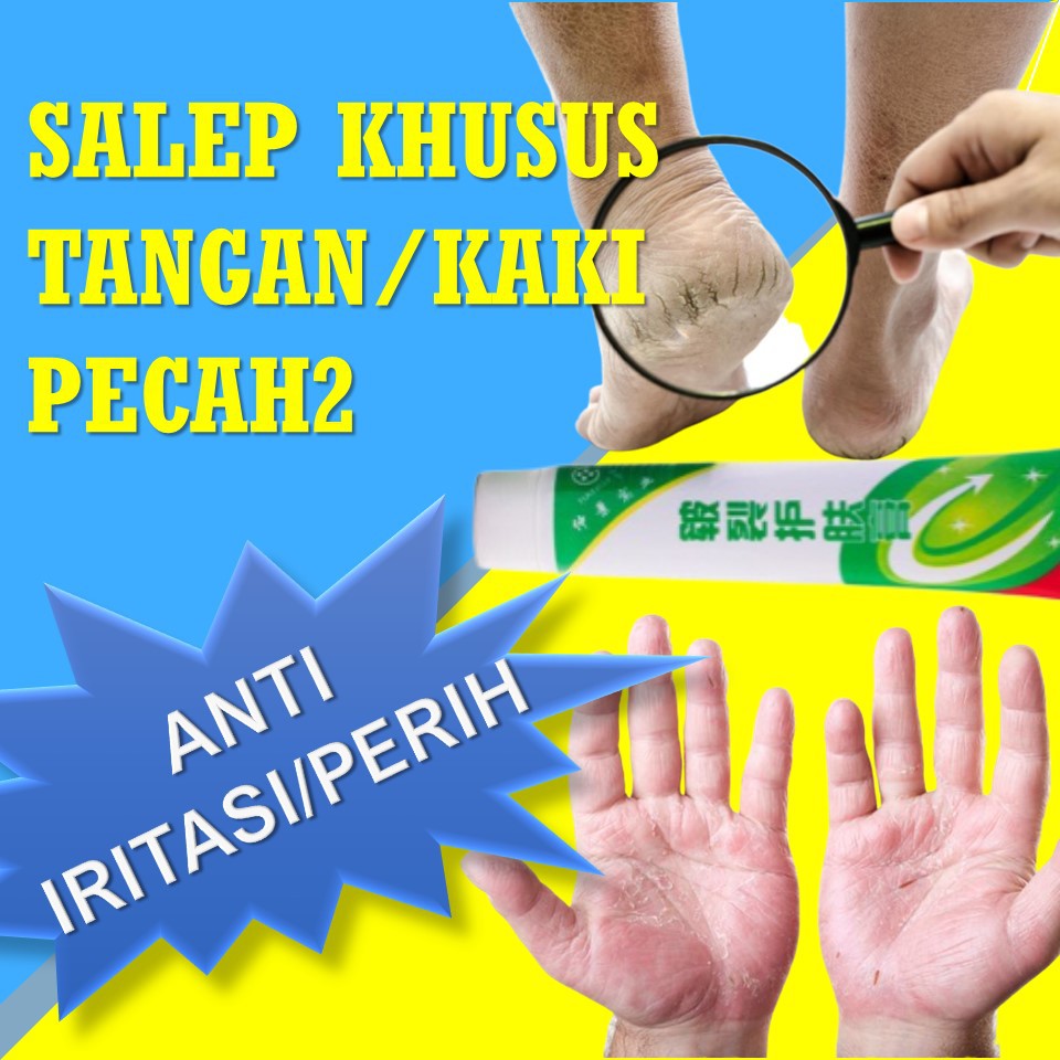 Jual [ASLI] - OBAT SALEP TUMITKU TUMIT KAKI PECAH PECAH / TANGAN KASAR ...