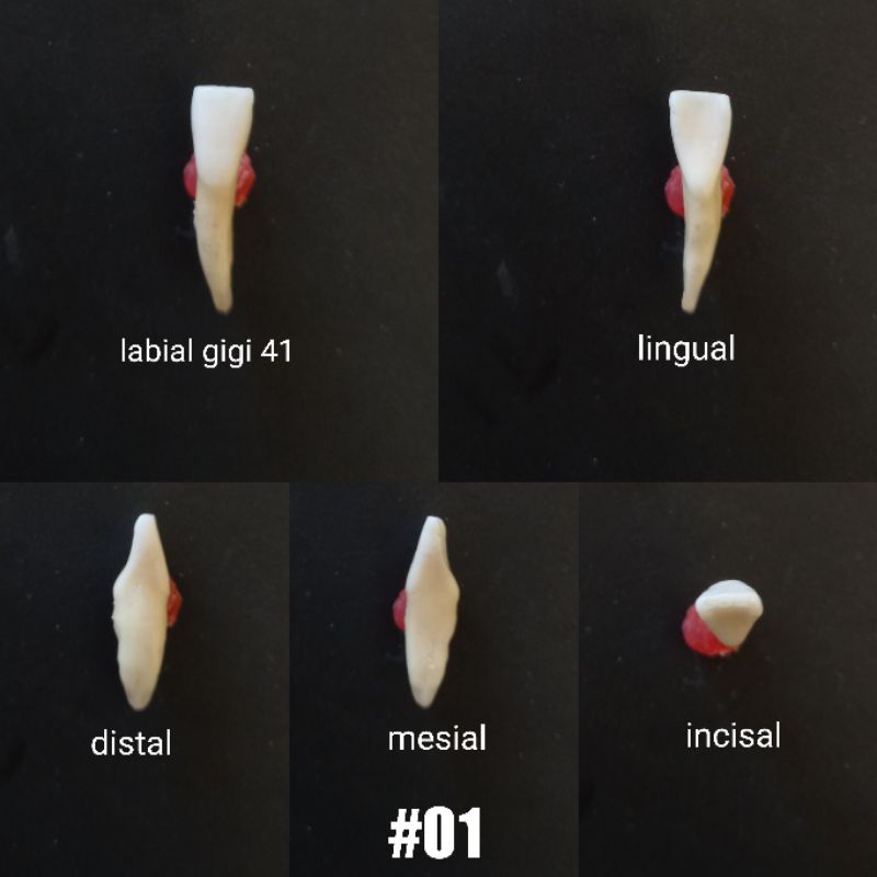 Jual Gigi Insisiv 41 | gigi insisiv rahang bawah kanan| Gigi untuk ...