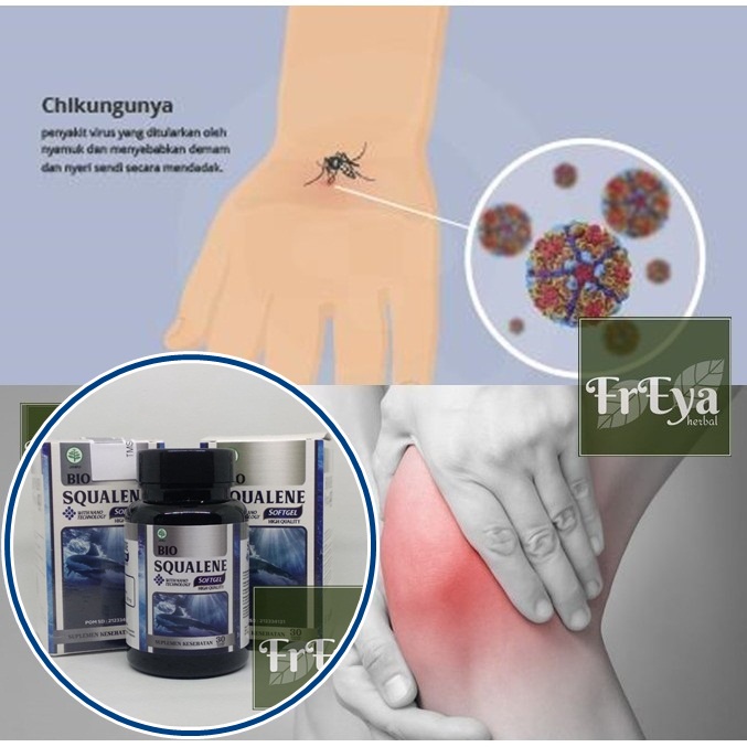 Jual OBAT FLU TULANG, OBAT HERBAL CHIKUNGUNYA (BISA COD) | Shopee Indonesia