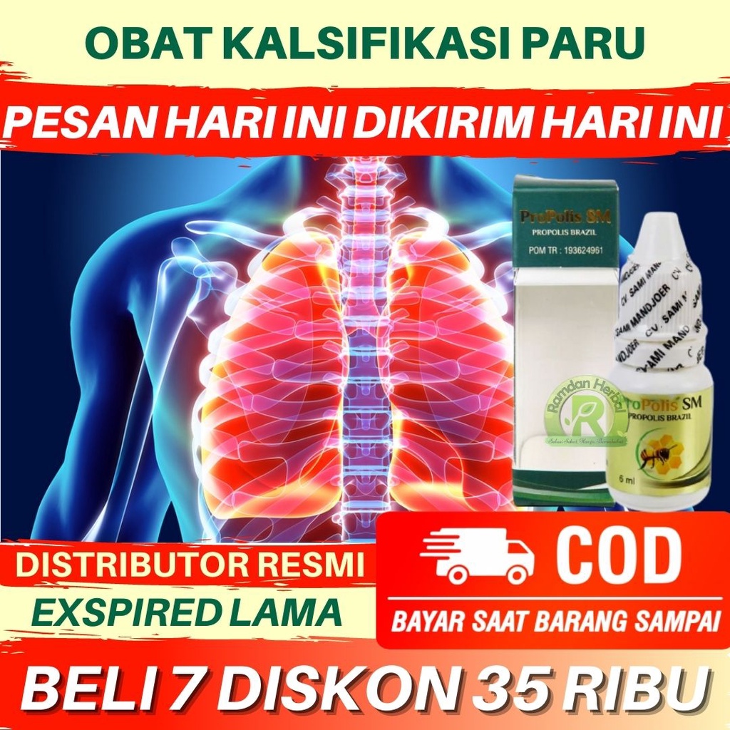 Jual Obat Kalsifikasi Paru Infeksi Paru Paru Masalah Pernapasan ISPA ...