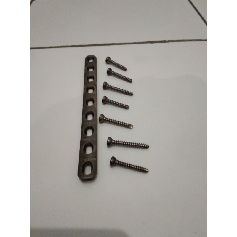 Jual Pen Platina Patah Tulang Kaki | Shopee Indonesia