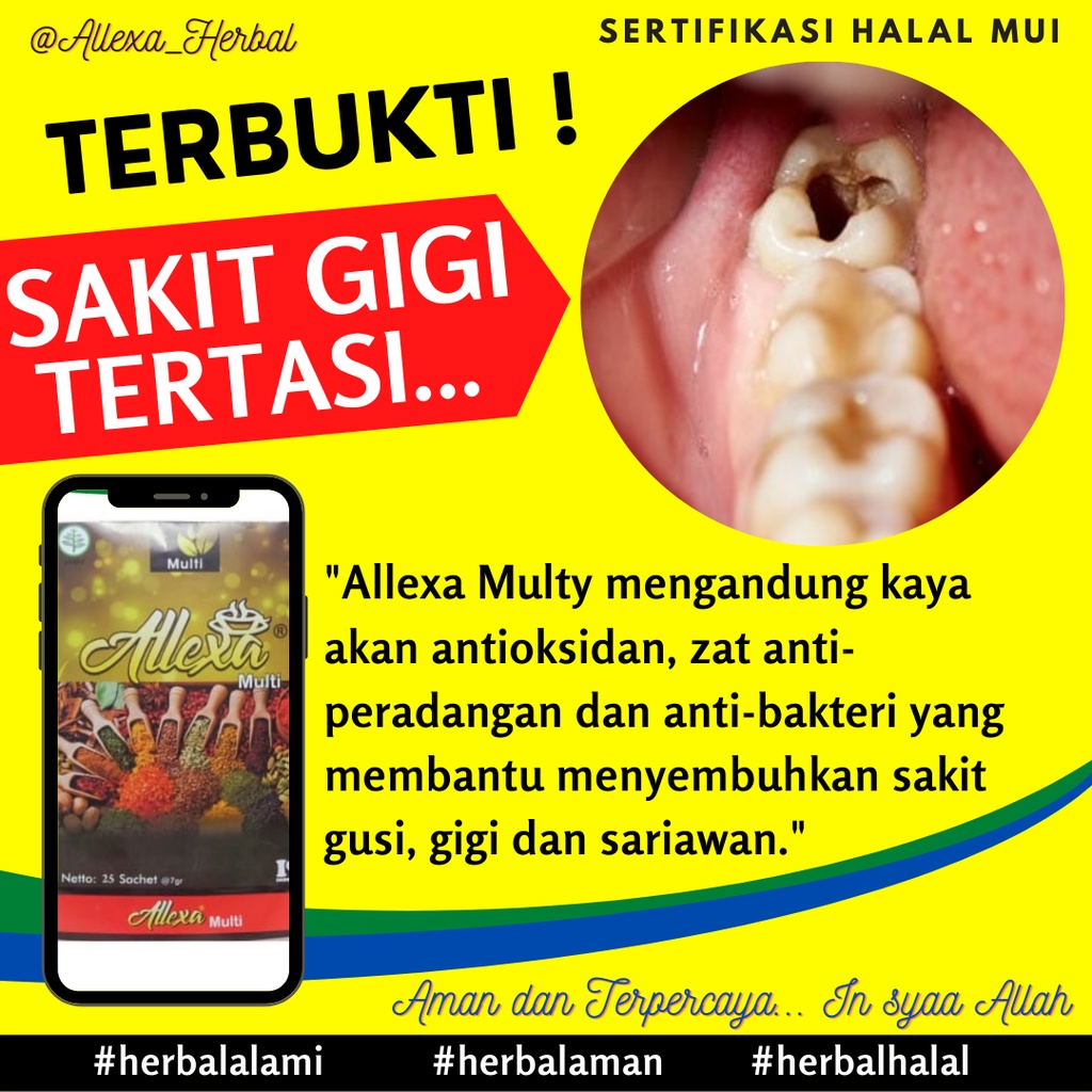 Jual ALLEXA MULTY - Obat Sakit Gigi - Gigi Berlubang - Gusi Bengkak Ampuh Allexa Multy Amazing ...