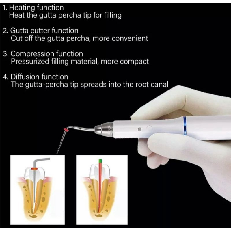 Jual OBTURATION PEN HEATED GUTTA PERCHA CUTTER Dental Plugger ...