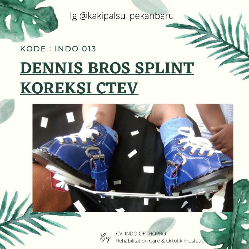 Jual Sepatu Ctev / kaki pengkor / dennis brown Splint / sepatu ortopedi ...
