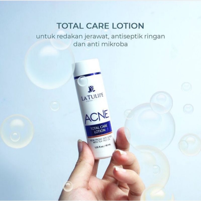 Jual LA TULIPE ACNE TOTAL CARE LOTION | Shopee Indonesia