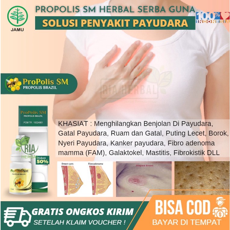 Jual Obat Alami Penghilang Benjolan Di Payudara Ibu Menyusui, Penghancur Kista Payu Dara ...