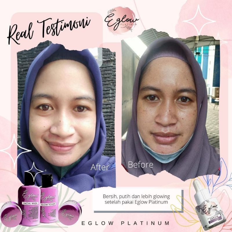 Jual EGLOW PLATINUM ORIGINAL WHETENING/ACNE | Shopee Indonesia