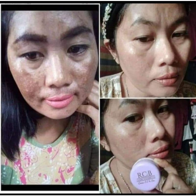 Jual CREAM RCB GLOW (kemasan lama) | Shopee Indonesia