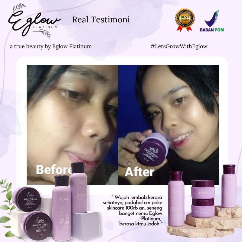 Jual Eglow Platinum Skincare | Shopee Indonesia