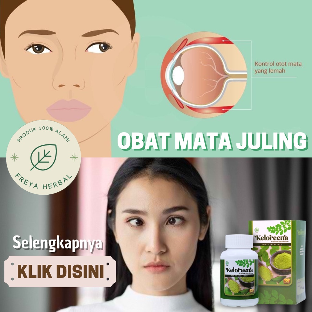 Jual OBAT MATA JULING, OBAT HERBAL STRABISMUS, OBAT MATA JERENG, OBAT ...