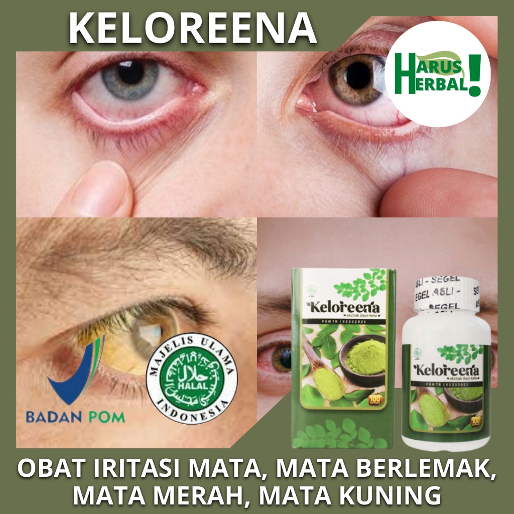 Jual Obat Atasi Iritasi Mata Dengan KELOREENA, Mata Iritasi Karna ...