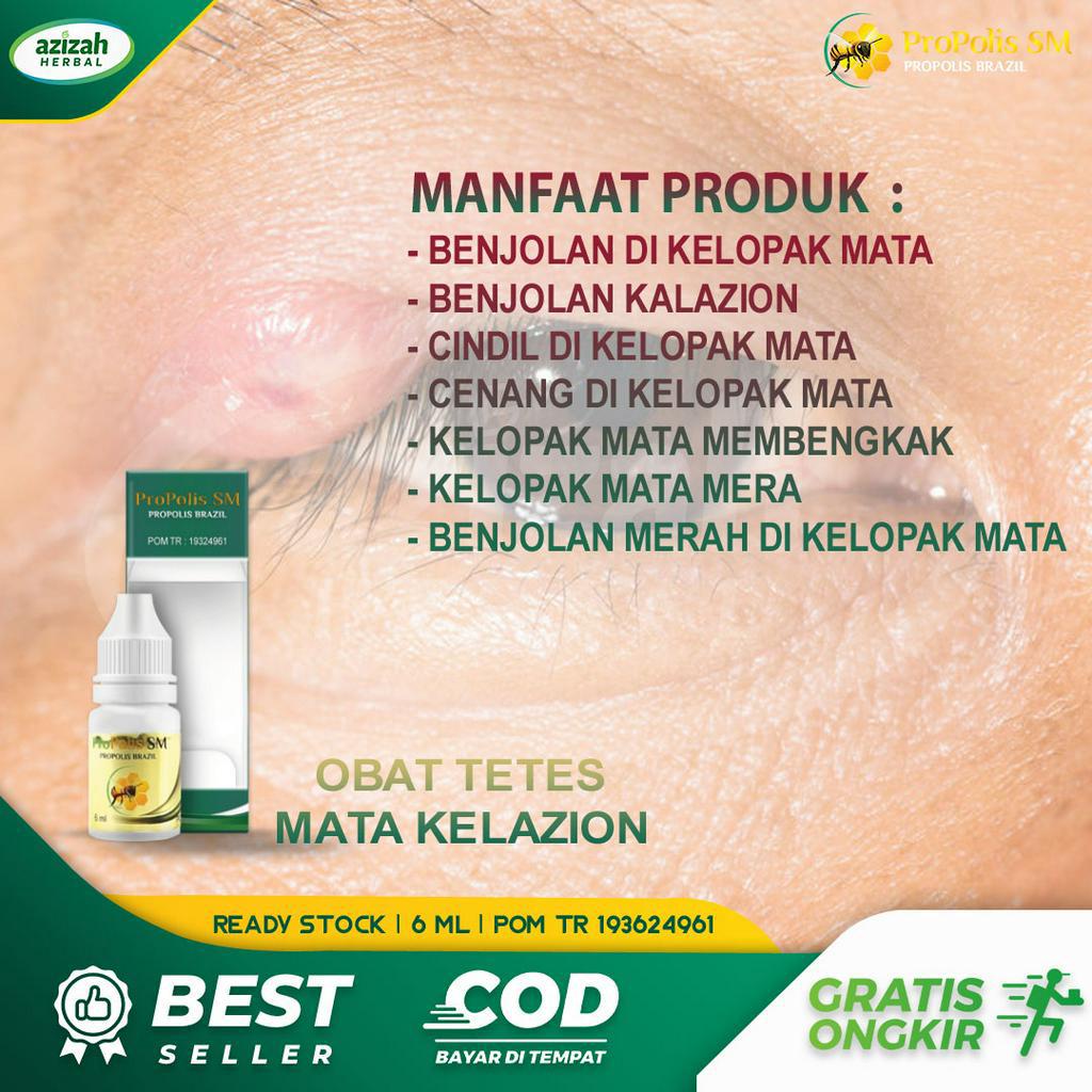 Jual Obat Mata Bintitan Bintit Di Kelopak Benjolan Merah Bernanah ...