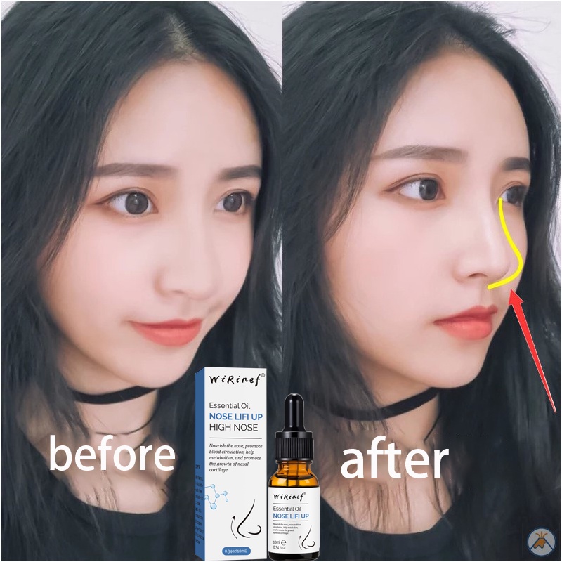 Jual Alat Hidung Pemancung Minyak Esensial Pemancung Hidung Minyak ...