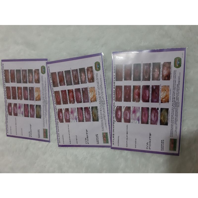 Jual Poster ATLAS IVA servik | Shopee Indonesia