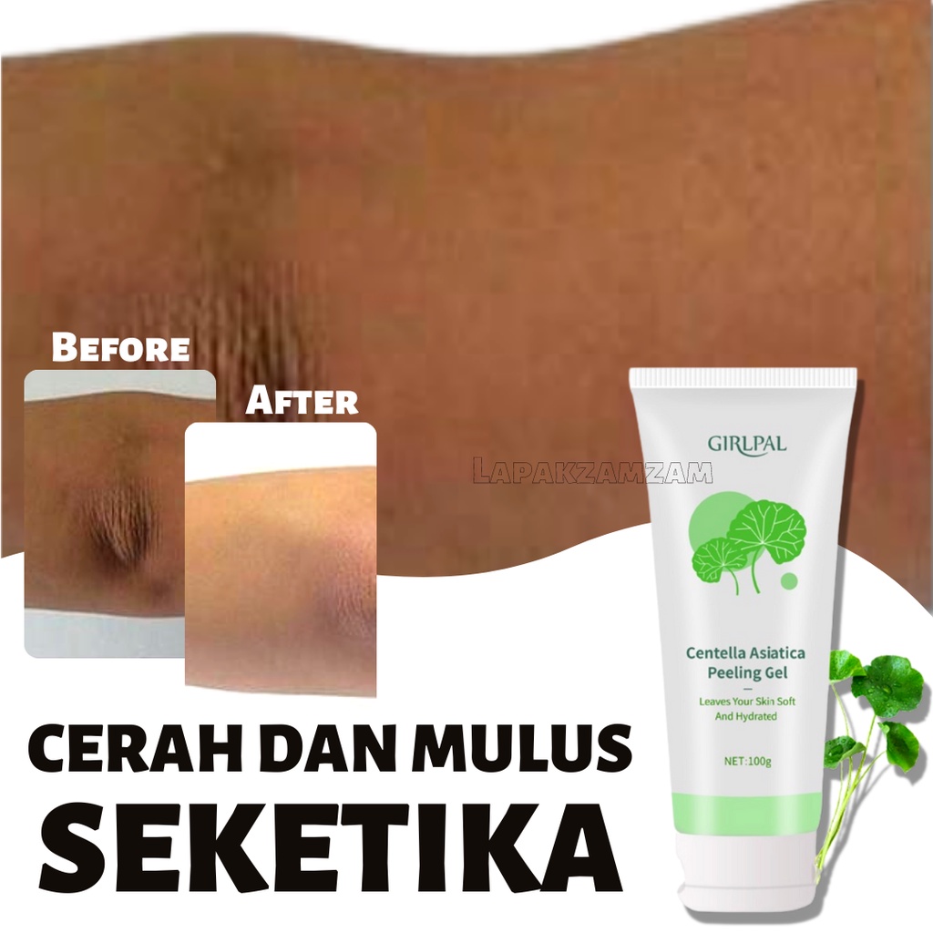 Jual Girlpal Peeling Gel Centella Asiatica Exfoliating Girlpal Centella Asiatica Peeling Gel ...