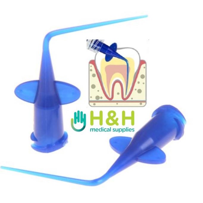 Jual Tip Irigasi Endo / Irigasi Endodontik / Tip CaOH / Dental ...