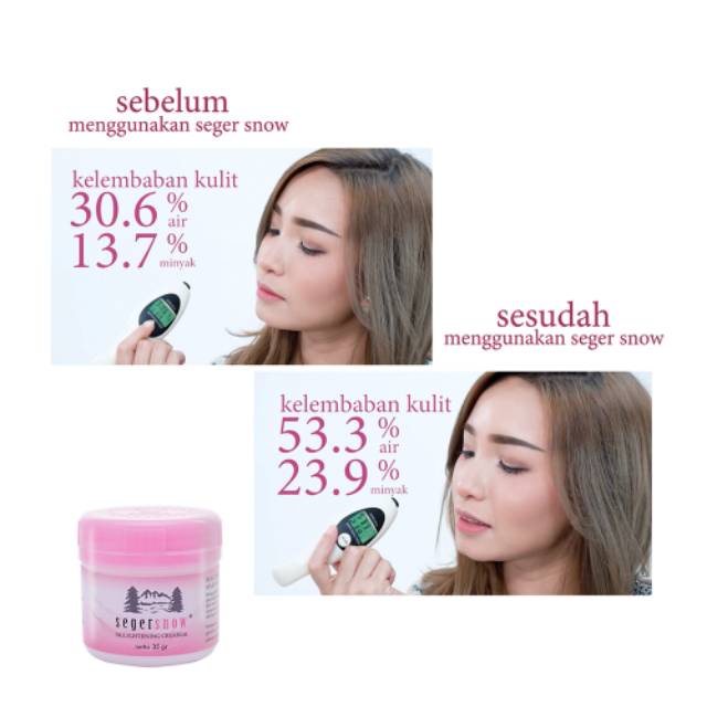 Jual Seger Snow Lightening Cream Mengandung Vitamin B3 Melembutkan dan ...