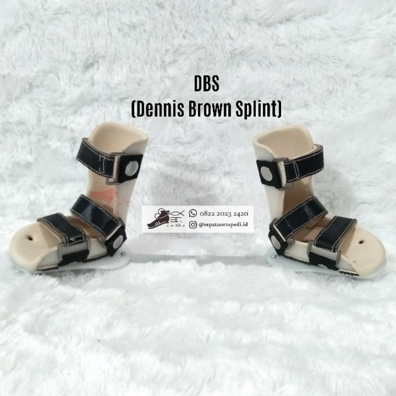 Jual Sepatu Bayi Dennis Brown Splint untuk koreksi CTEV / Club Foot ...