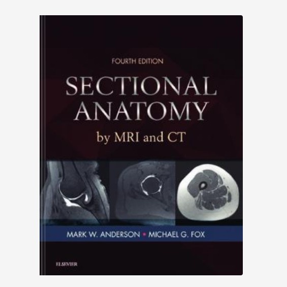 Jual Sectional Anatomy by MRI and CT Mark W. Anderson MD ( PAPERBACK ...