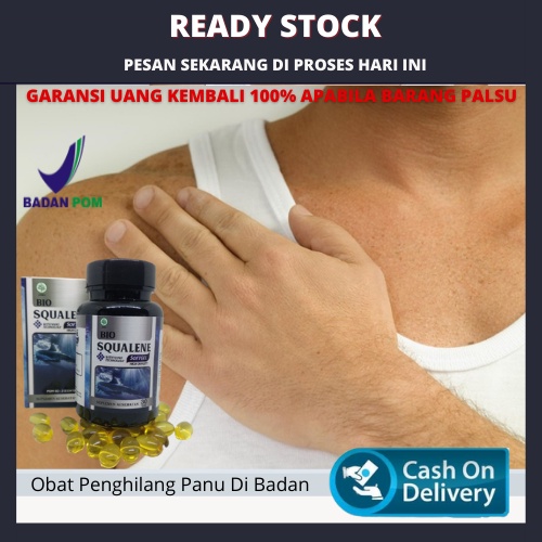 Jual Obat Penghilang Panu Di Badan, Panu Bandel, Panu Membandel, Badan ...