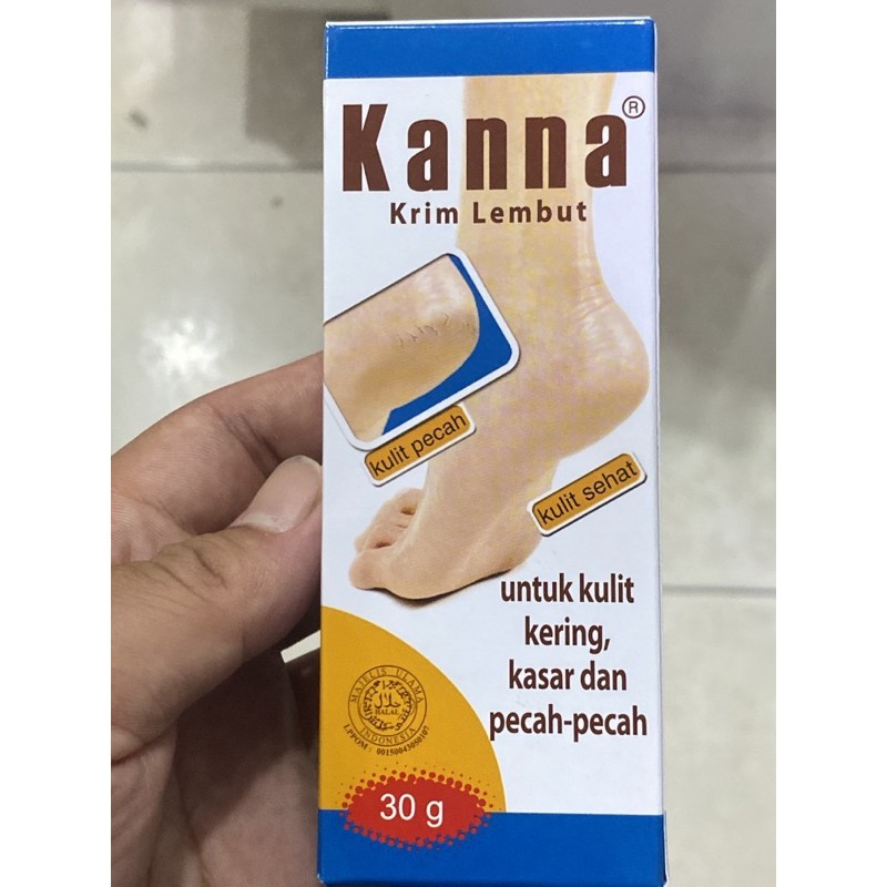 Jual Kana cream 30gr | Shopee Indonesia