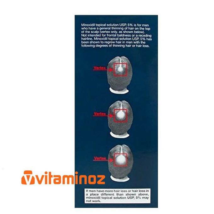 Jual SUPLEMEN-VITAMIN-RAMBUT- PAKET KIRKLAND MINOXIDIL 60ML & PURITAN ... Jual SUPLEMEN-VITAMIN-RAMBUT- PAKET KIRKLAND MINOXIDIL 60ML & PURITAN ...