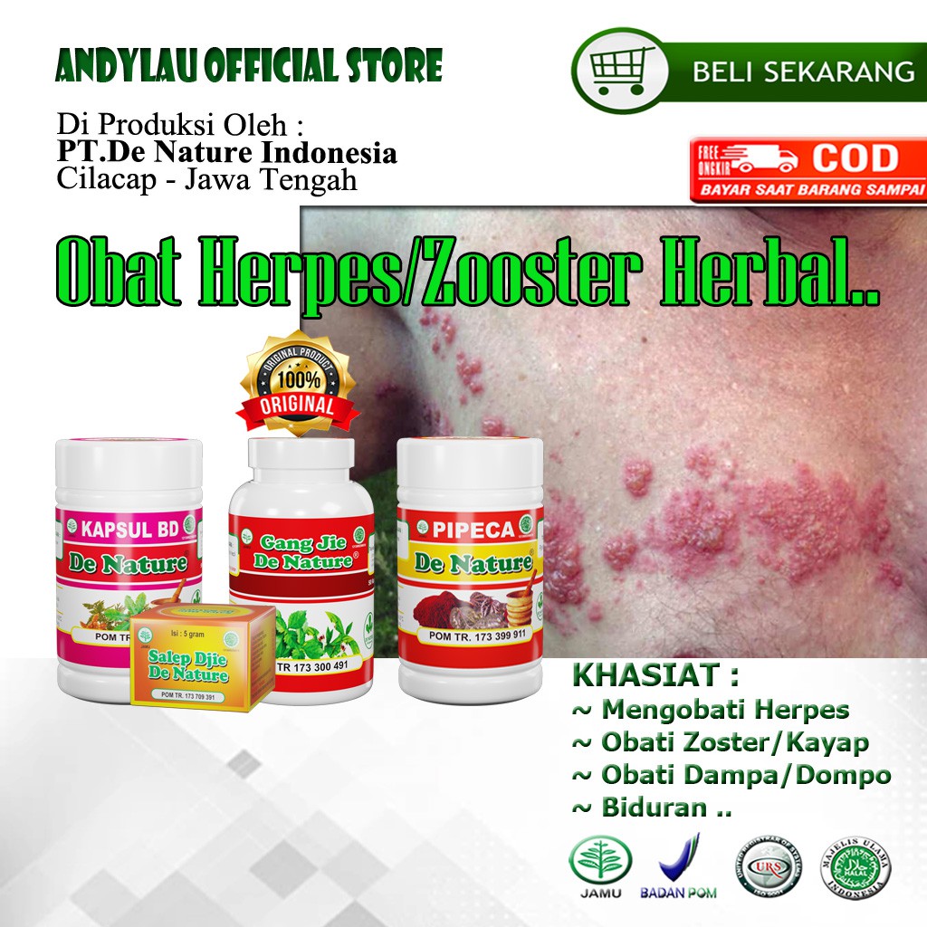 Jual Obat Zoster Herpes Kayap Dampa Dompo Cacar Ular Alergi Kulit ...