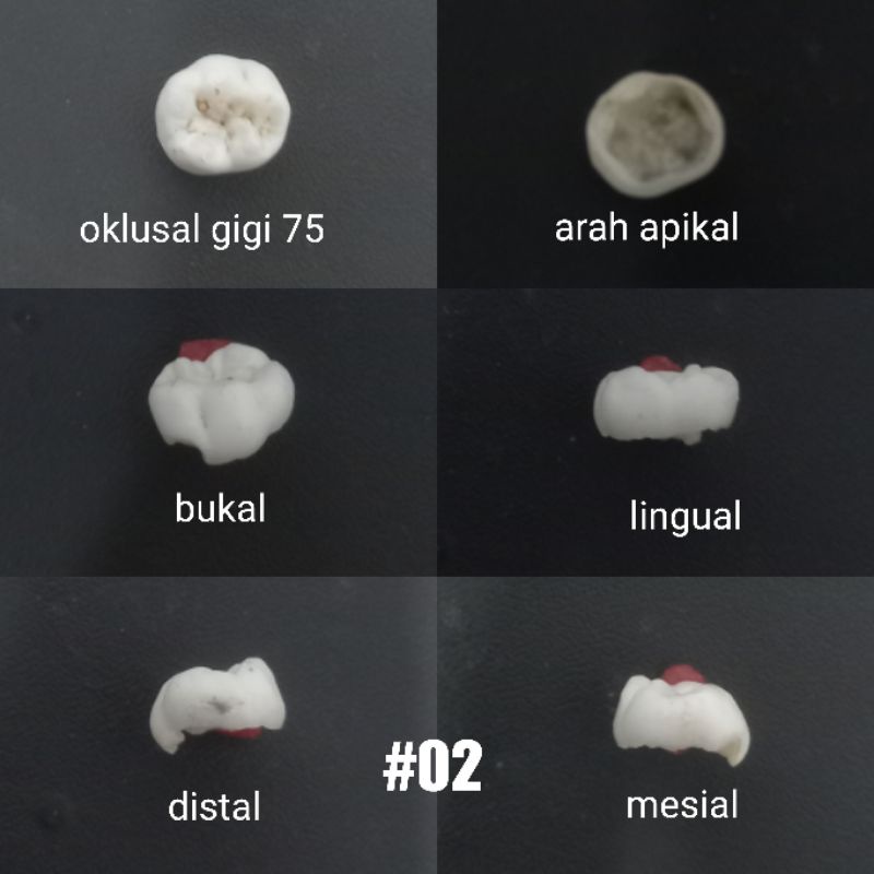 Jual Gigi Molar Anak 75 kode Praktikum | endo konservasi | Gigi untuk ...