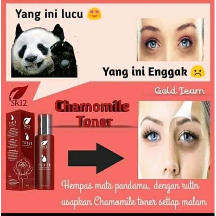 Jual Toner Chamomille / Toner Mata Panda / Toner Kulit Meradang / Toner ...