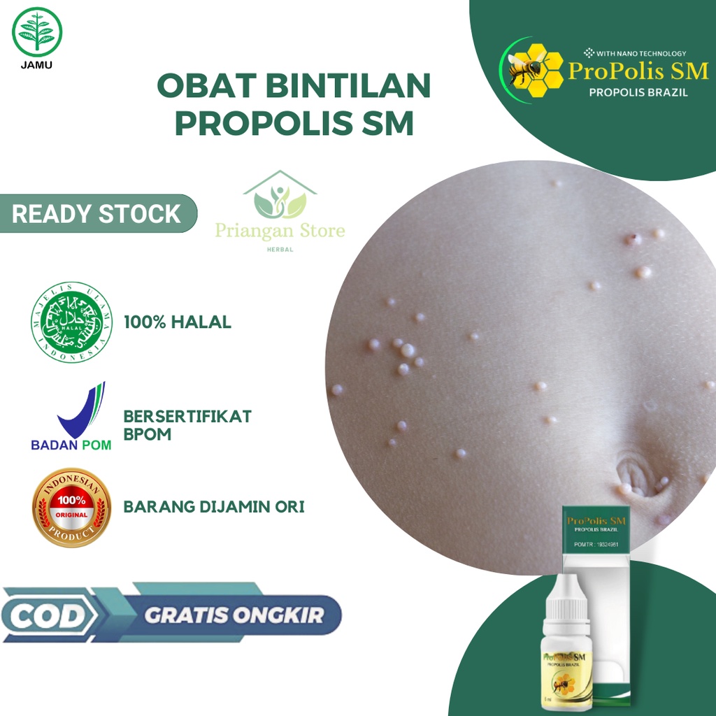 Jual Obat Bintil untuk Anak & Dewasa, Obat Tetes Kutil Kelamin, Obat ...