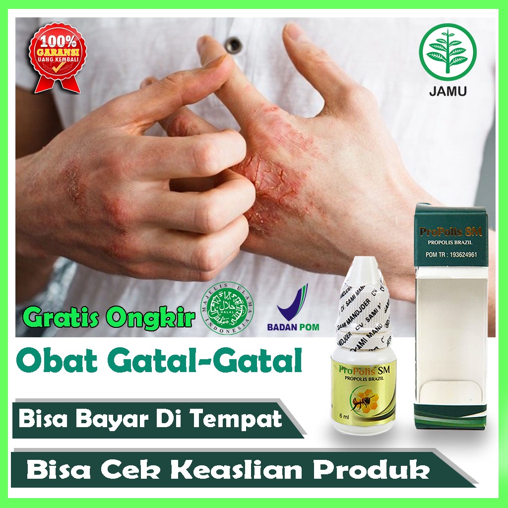 Jual Obat Gatal Selangkangan Gatel Menghitam, Untuk Babak Panu Jamur ...