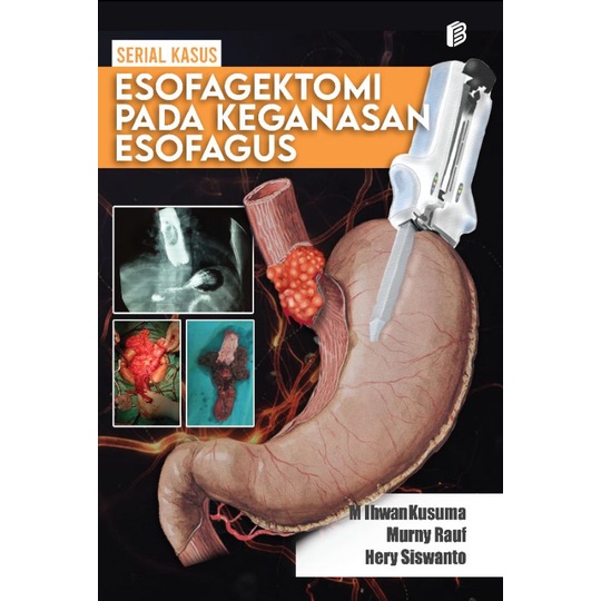 Jual Serial Kasus Esofagektomi pada Keganasan Esofagus | Shopee Indonesia