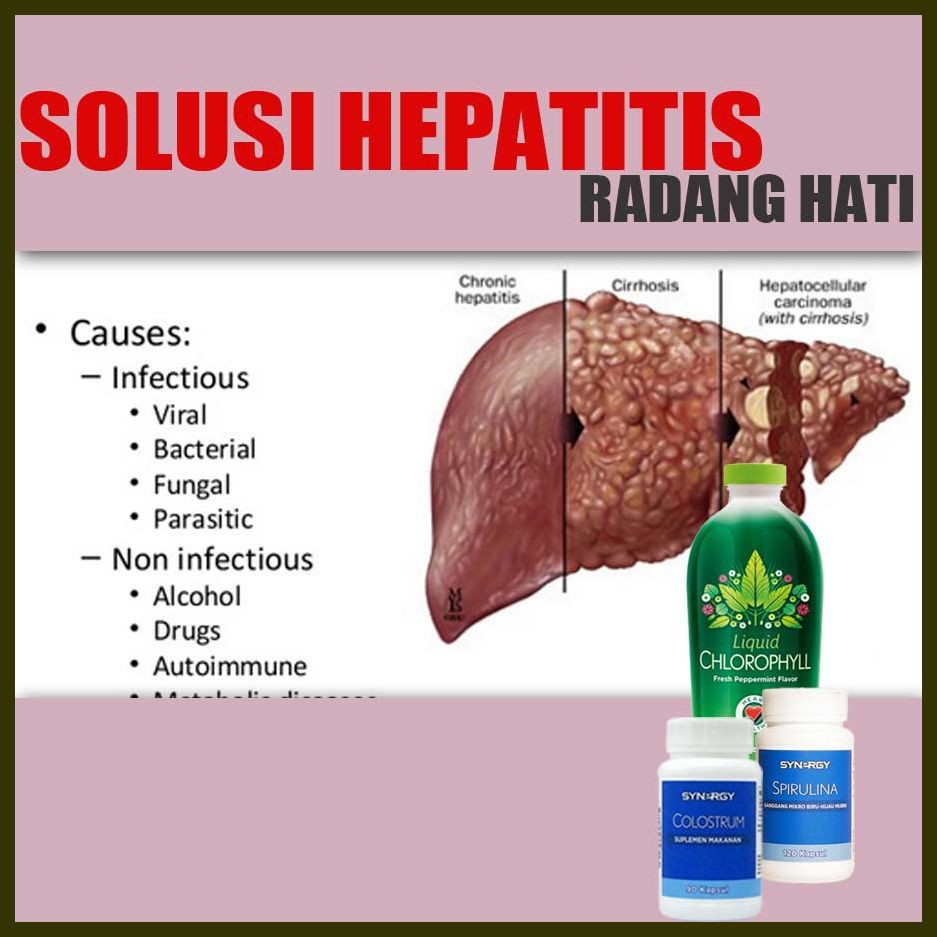 Jual Obat Sakit Ulu Hati Melilit Maxi Pack Izin BPOM | Shopee Indonesia