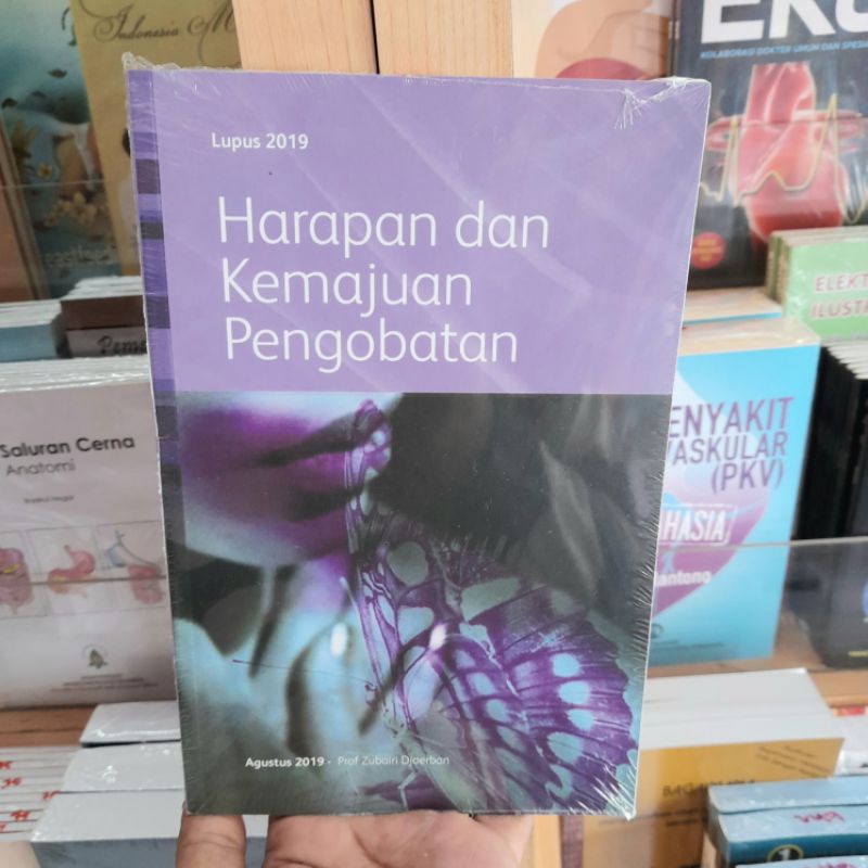 Jual Lupus: Harapan dan Kemajuan Pengobatan - Zubairi Djoerban Buku ... Jual Lupus: Harapan dan Kemajuan Pengobatan - Zubairi Djoerban Buku ...